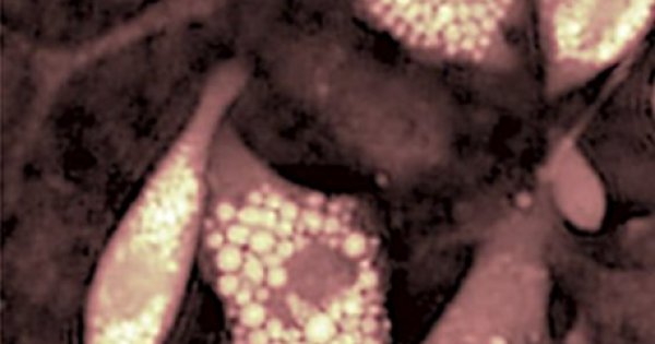 Quantitative phase imaging of biological specimens using DHM